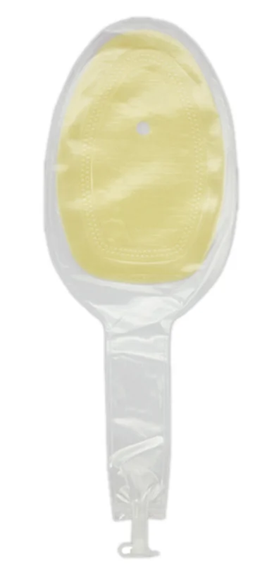 Convatec Eakin Fistula and Wound Pouch, Transparent with Remote ...
