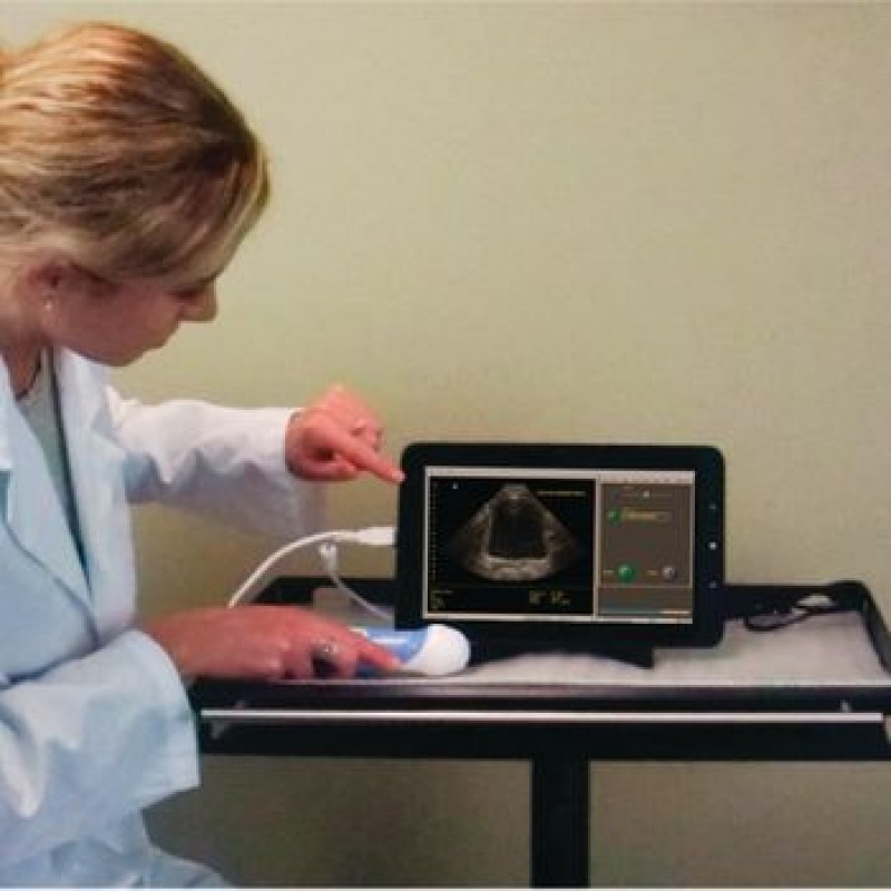 Interson Tablet Bladder Scanner ViewBladder 10 99-9008