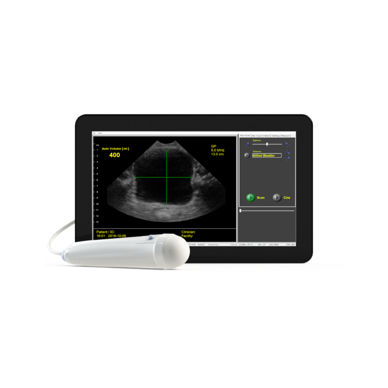 Interson Tablet Bladder Scanner ViewBladder 10 99-9008