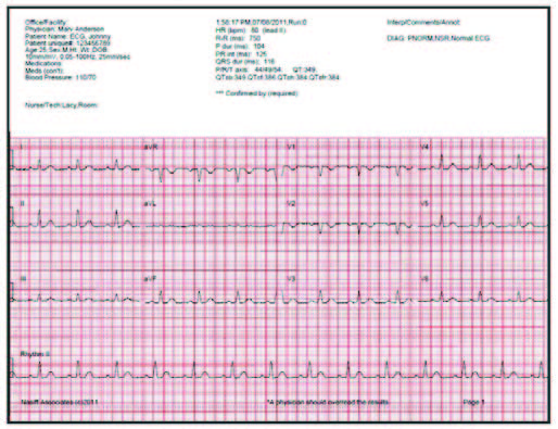 Nasiff CardioResting PC Based ECG System CC-ECG1 BLE