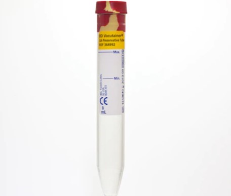 BD Plus Plastic Conical Tube with Preservative for Urinalysis 364992